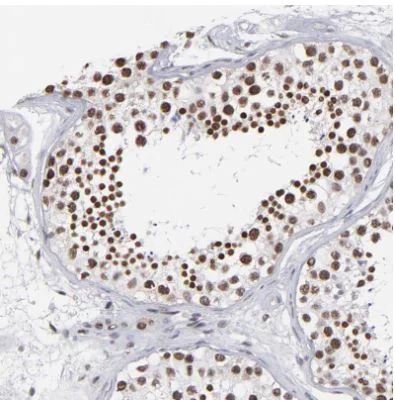 Anti-IMP3 antibody (ab273131) | Abcam