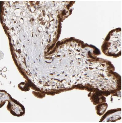 Anti-IMP3 antibody (ab273131) | Abcam