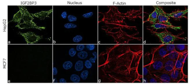 Anti-IMP3 antibody [RP23040260] (ab313556) | Abcam