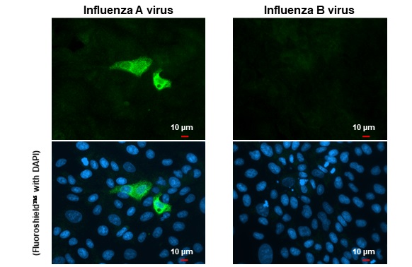 Anti-Influenza A virus H1N1 NA Neuraminidase antibody [HL1108] - BSA ...