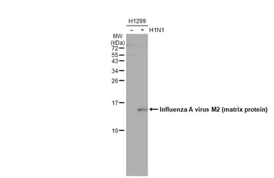 Anti-Influenza A virus M2 (matrix protein) antibody [HL1856] - BSA and ...