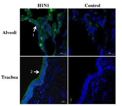 Influenza A Virus Nucleoprotein抗体[AA5H] (ab20343)| Abcam中文官网