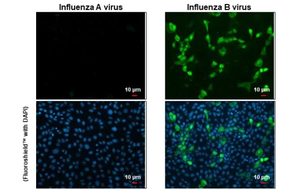 Anti-Influenza B virus Nucleoprotein antibody [HL1068] - BSA and Azide ...