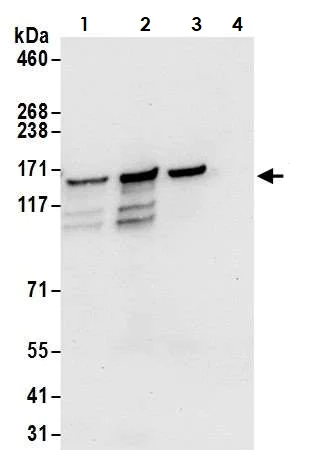 Anti-INPPL1/SHIP-2 antibody (ab70267) | Abcam
