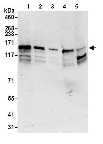 Anti-INPPL1/SHIP-2 antibody (ab70267) | Abcam