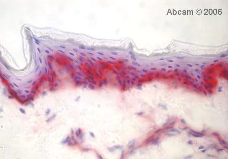 Anti-Integrin alpha 3 antibody [F35 177-1] (ab20140) | Abcam