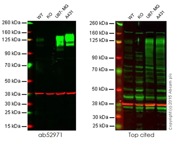 Integrin beta 1抗体[EP1041Y] (ab52971)| Abcam中文官网
