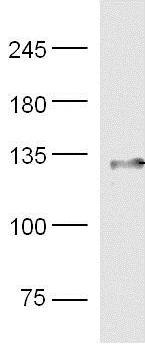 Anti-Integrin beta 1 + Integrin alpha 3 antibody (ab217145) | Abcam