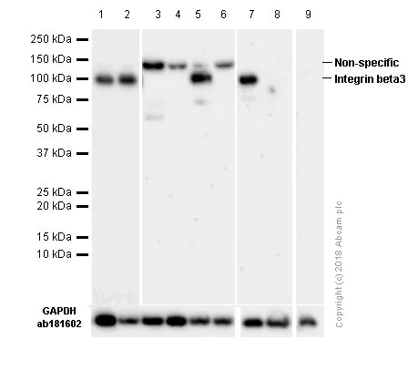 Anti-Integrin beta 3 antibody [ERP17507] (ab179473) | Abcam