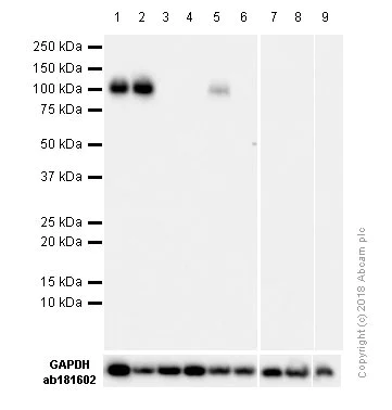 Anti-Integrin beta 3 antibody [SP324] (ab227702) | Abcam