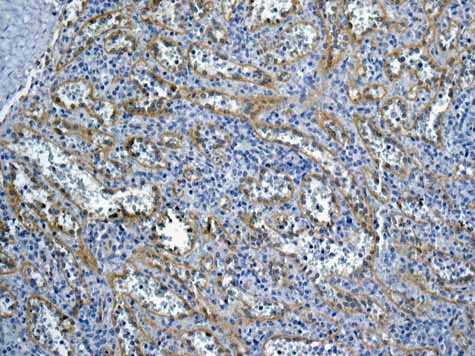 Integrin beta 4抗体 (ab236251)| Abcam中文官网