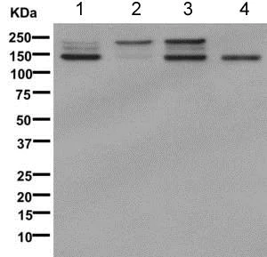 Anti-Integrin beta 4 antibody [EPR8558(2)] KO Tested (ab168386) | Abcam