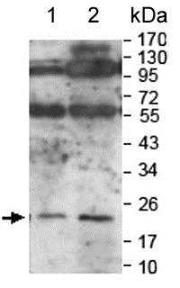 Anti-Interferon beta antibody (ab140211) | Abcam
