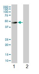 Anti-Intrinsic Factor antibody (ab102049) | Abcam