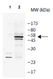 Anti-Intron-encoded endonuclease I-SceI antibody (ab216263) | Abcam