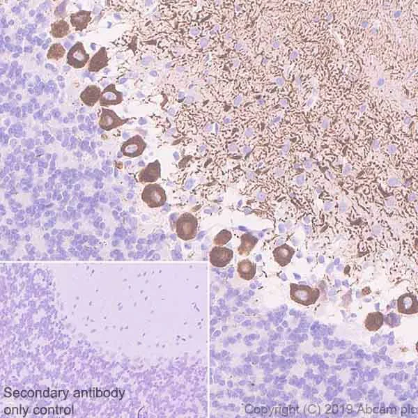 IP3 receptor抗体[L24/18] - BSA and Azide free (ab255762)| Abcam中文官网