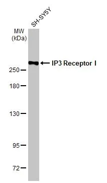 IP3 Receptor I抗体[HL1541] (ab308165)| Abcam中文官网