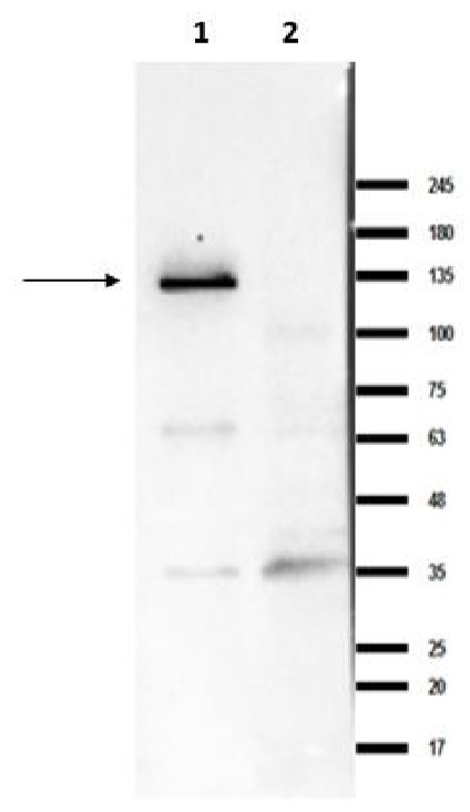 Anti-IRE1 antibody (ab235171) | Abcam