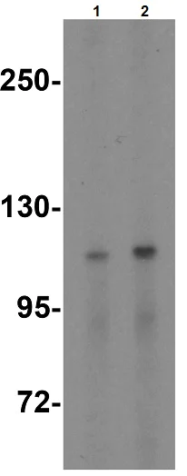 Anti-IRE1 antibody (ab37073) | Abcam