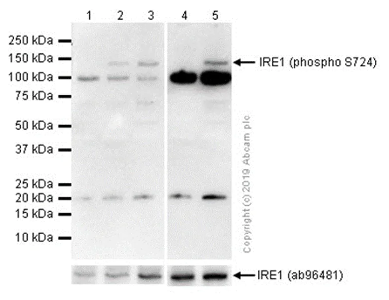 Anti-IRE1 (phospho S724) antibody [EPR5253] (ab124945) | Abcam
