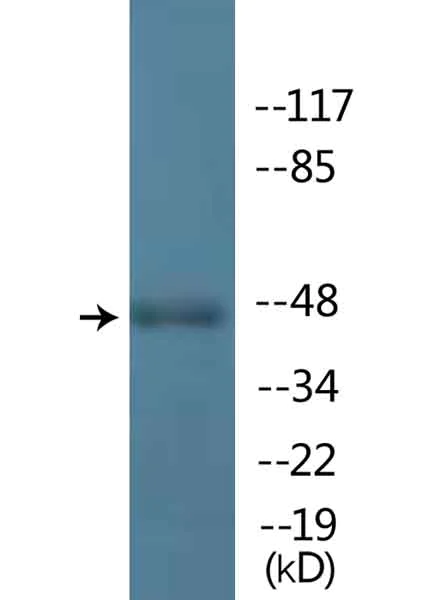 Anti-IRF3 (phospho S396) antibody (ab138449) | Abcam