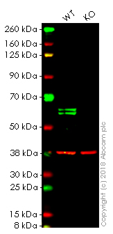 Anti-IRF5 antibody [10T1] (ab33478) | Abcam