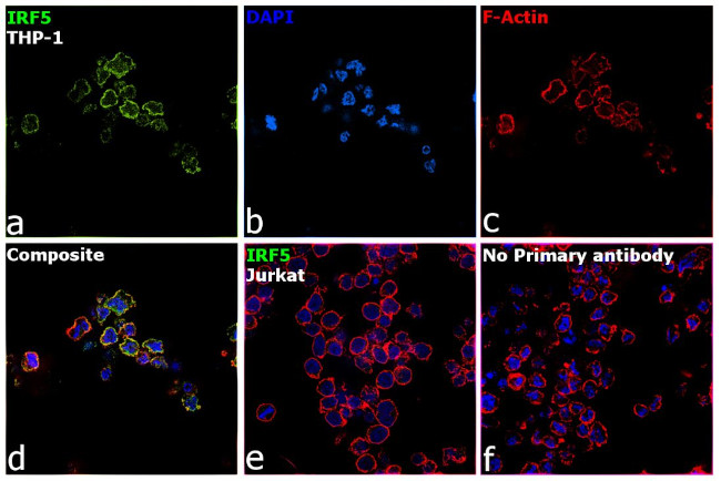Anti-IRF5 Antibody [RP23040171] (ab313466) | Abcam