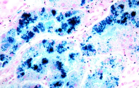 Iron Stain Kit (Prussian Blue Stain) (ab150674) | Abcam