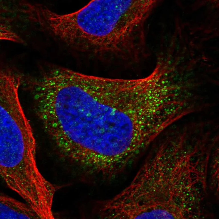 Iroquois homeobox protein 3/IRX3抗体 (ab247145)| Abcam中文官网