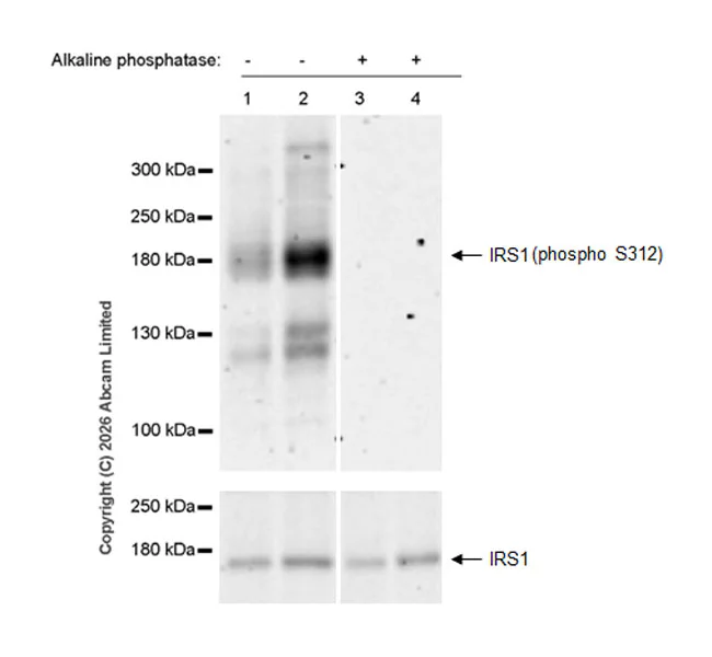 Anti-IRS1 (phospho S312) antibody [EPR29078-524R] (ab327340) | Abcam中文官网