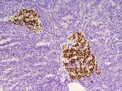 Anti-Islet 1 antibody [1B1] - Neural Stem Cell Marker (ab86501) | Abcam