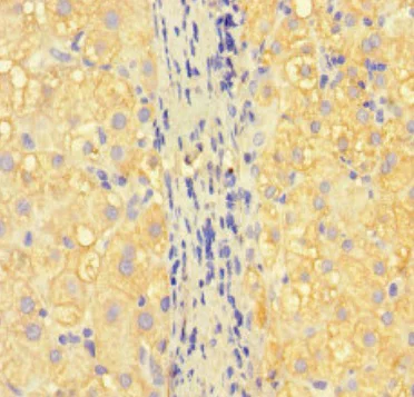 Anti-ISPD antibody (ab222793) | Abcam