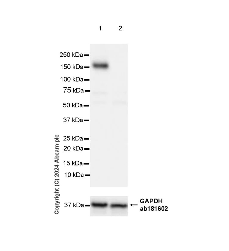 Anti-ITGA11 antibody [EPR28689-21] KO Tested (ab316249) | Abcam