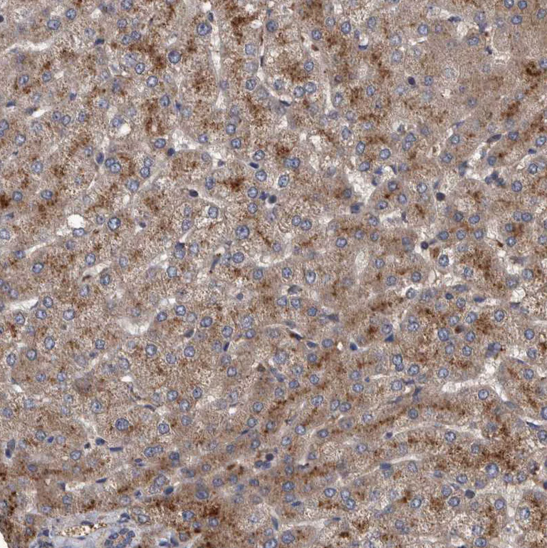 Anti-ITIH3 antibody (ab254782) | Abcam