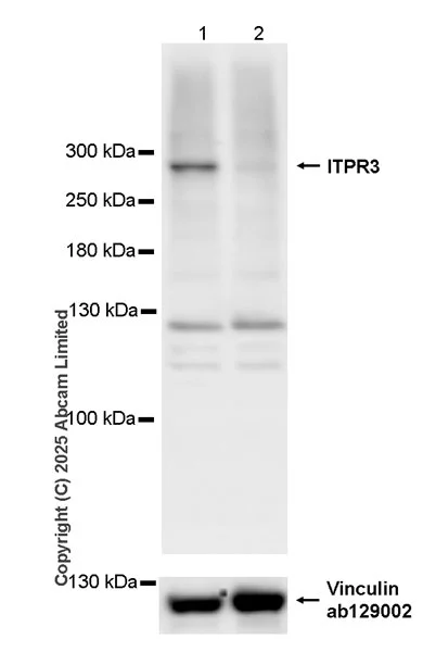 Anti-ITPR3 antibody [EPR25276-304] (ab325503) | Abcam中文官网