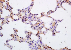 Anti-JAK3 antibody (ab203611) | Abcam