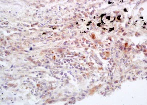 Anti-JAK3 antibody (ab203611) | Abcam