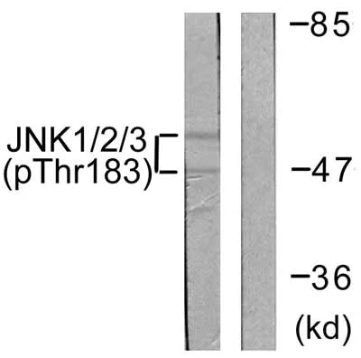 Anti-JNK1 + JNK2 + JNK3 (phospho T183 + Y185) antibody (ab59196) | Abcam