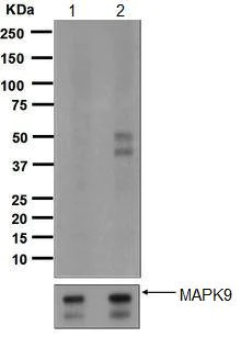 Anti-JNK1 + JNK2 + JNK3 (phospho T183+T183+T221) antibody [EPR5693] (ab124956) | Abcam