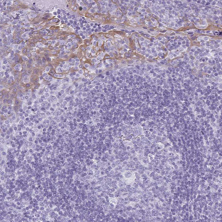 Anti-K78 antibody (ab122578) | Abcam