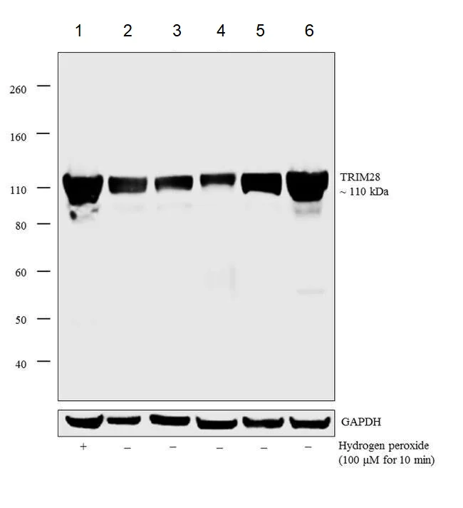 Anti-KAP1 antibody [20C1] (ab22553) | Abcam