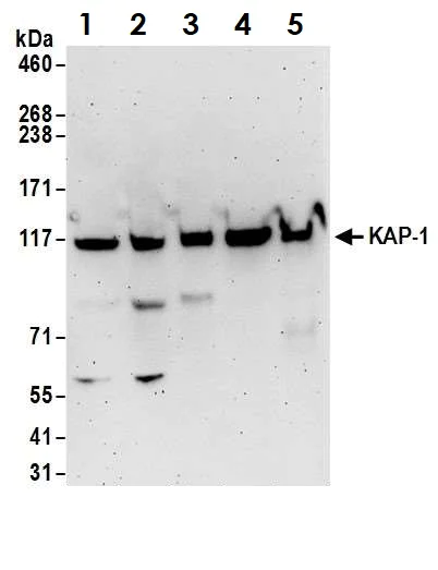 Anti-KAP1 antibody (ab10483) | Abcam