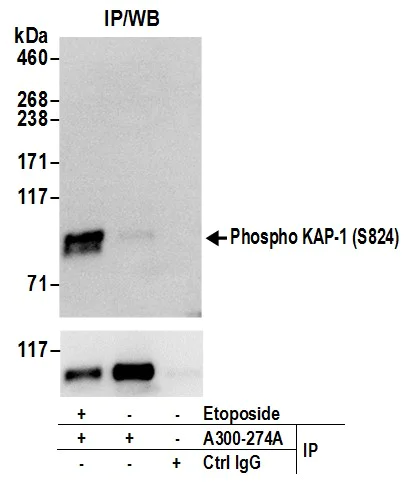 Anti-KAP1 (phospho S824) antibody (ab70369) | Abcam
