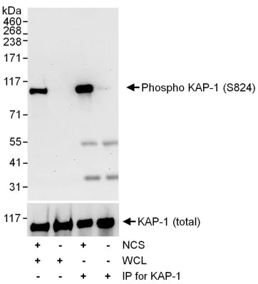 Anti-KAP1 (phospho S824) antibody (ab70369) | Abcam