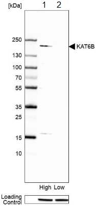 Anti-KAT6B / MORF antibody. Rabbit polyclonal (ab246879) | Abcam