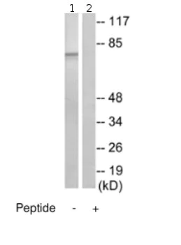 Anti-KAT7 / Hbo1 / MYST2 antibody (ab70183) | Abcam