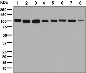 Anti-KDM1/LSD1 antibody [EPR6825] - Nuclear Marker and ChIP Grade ...