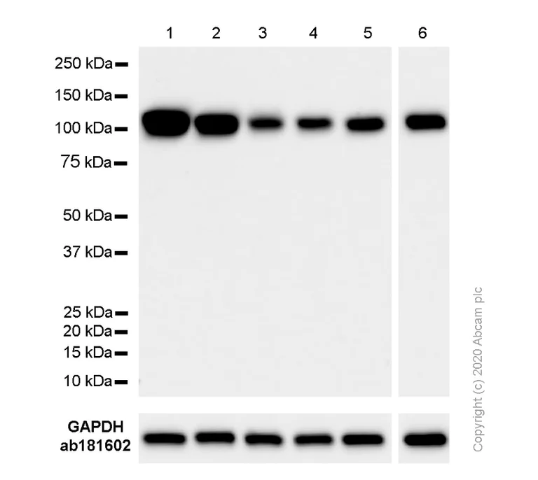KDM1/LSD1抗体[EPR6825] - Nuclear Marker and ChIP Grade (ab129195)| Abcam中文官网