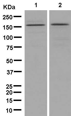 Anti-KDM5B / PLU1 / Jarid1B antibody [EPR12704] (ab181089) | Abcam