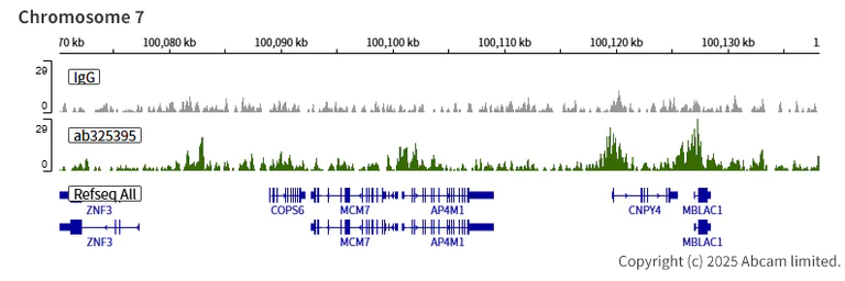 Anti-KDM5B / PLU1 / Jarid1B antibody [EPR30394-502] (ab325395) | Abcam